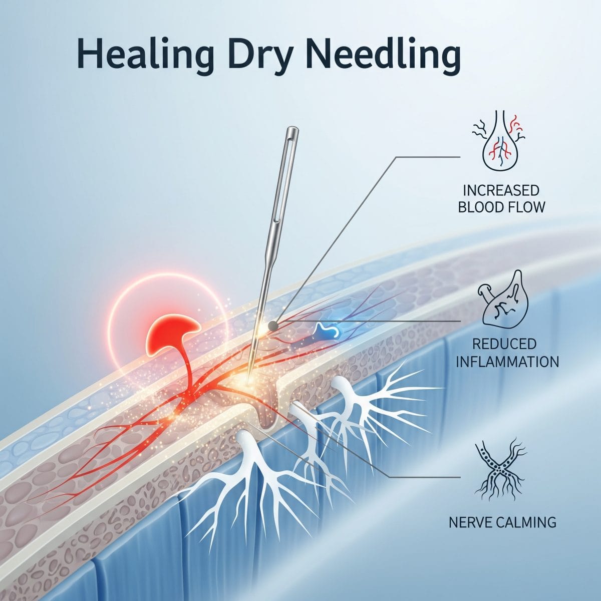 Integrative Dry Needling Therapy | Relieve Pain & Improve Mobility
